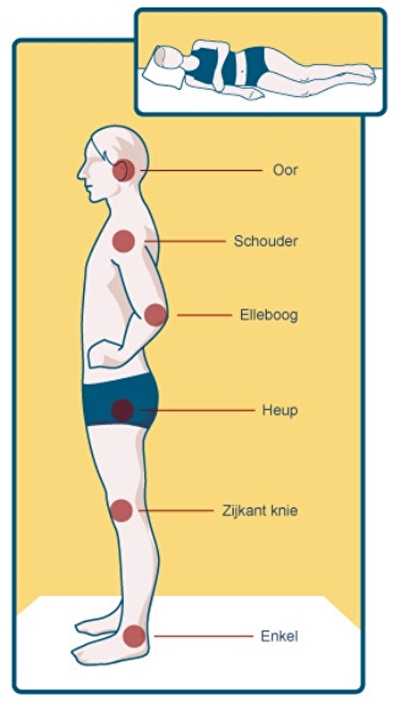 Decubitus of doorliggen | Bravis
