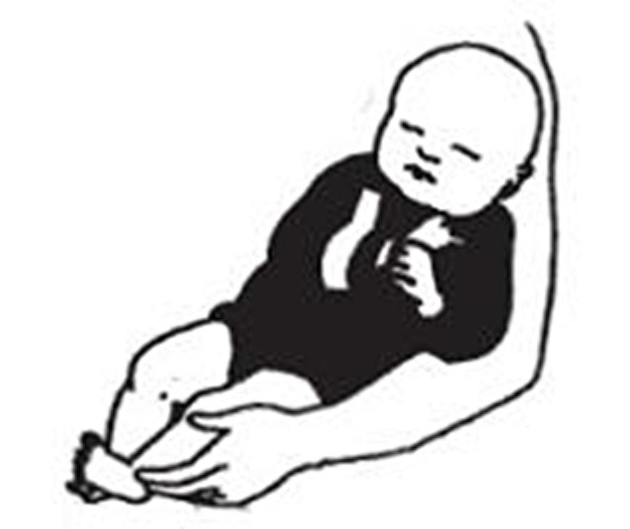 Baby met schouderdystocie | Bravis